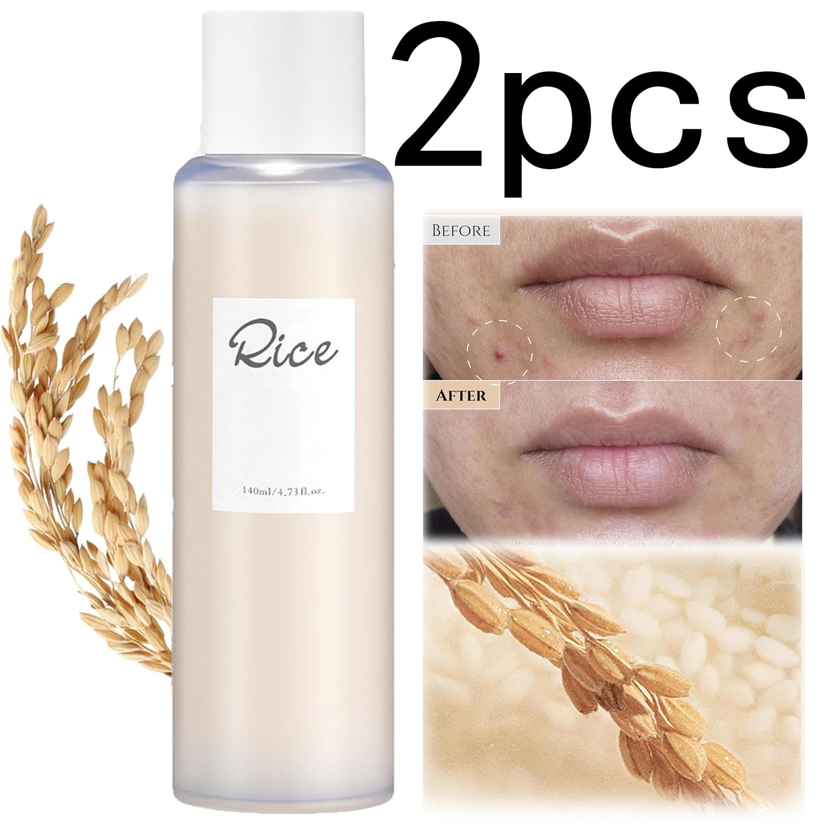Rice Toner,Anua Toner,Replenishing Rice Facial Sebum Toner for Oily ...