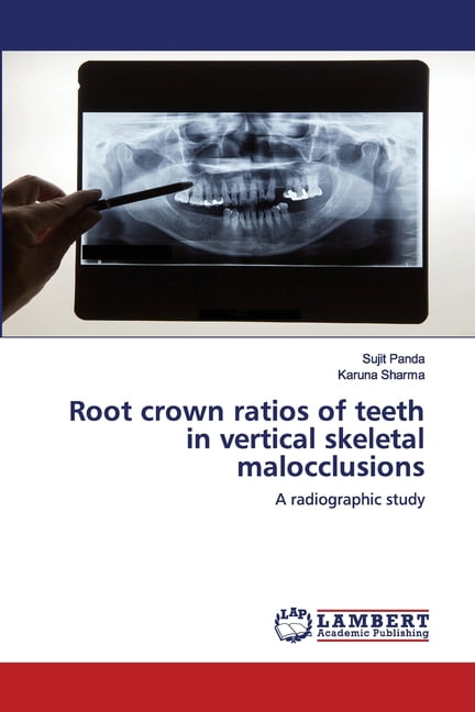 Root crown ratios of teeth in vertical skeletal malocclusions ...