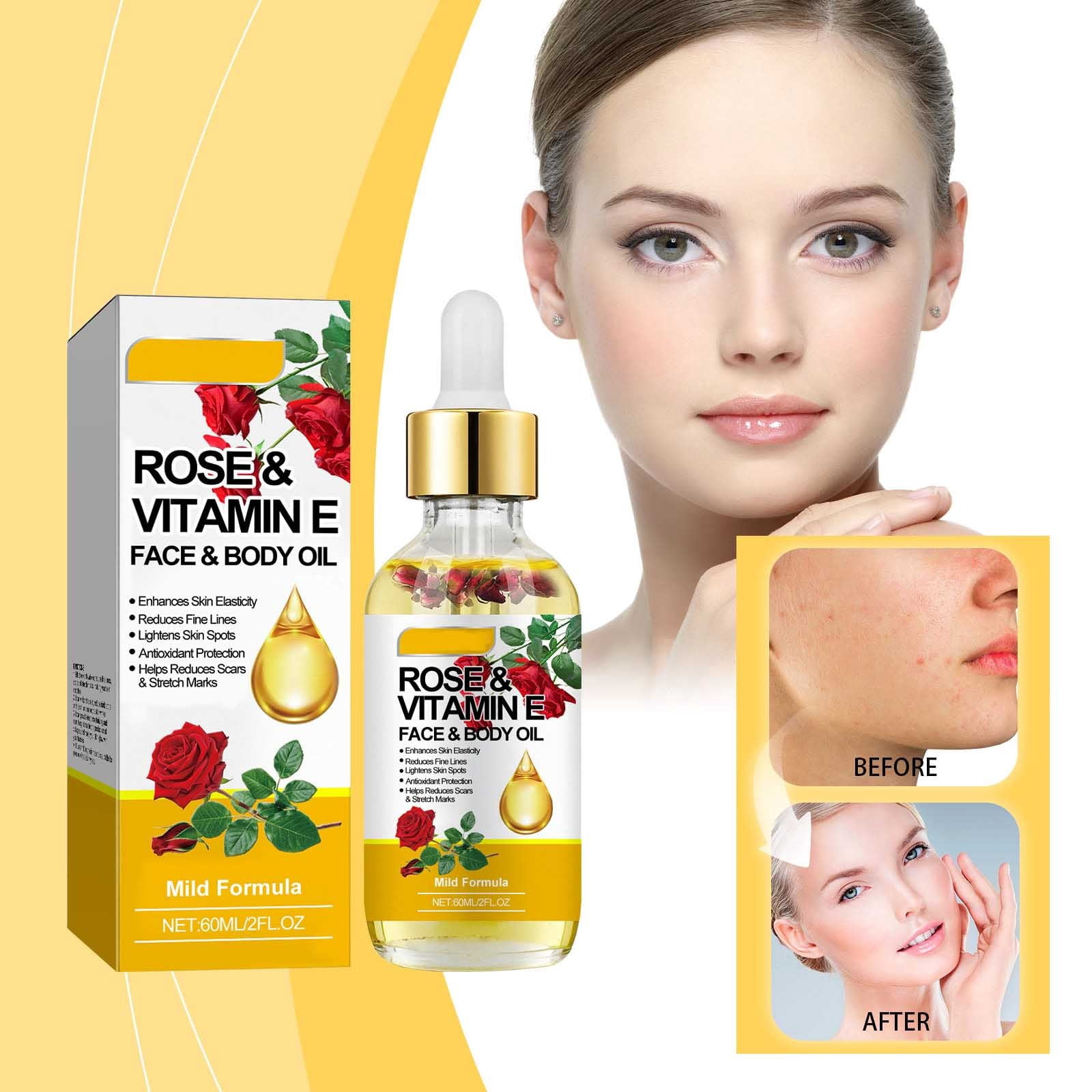 Rose Vitamin E And Moisturizing Oil Nourishes The Body Reduces And ...