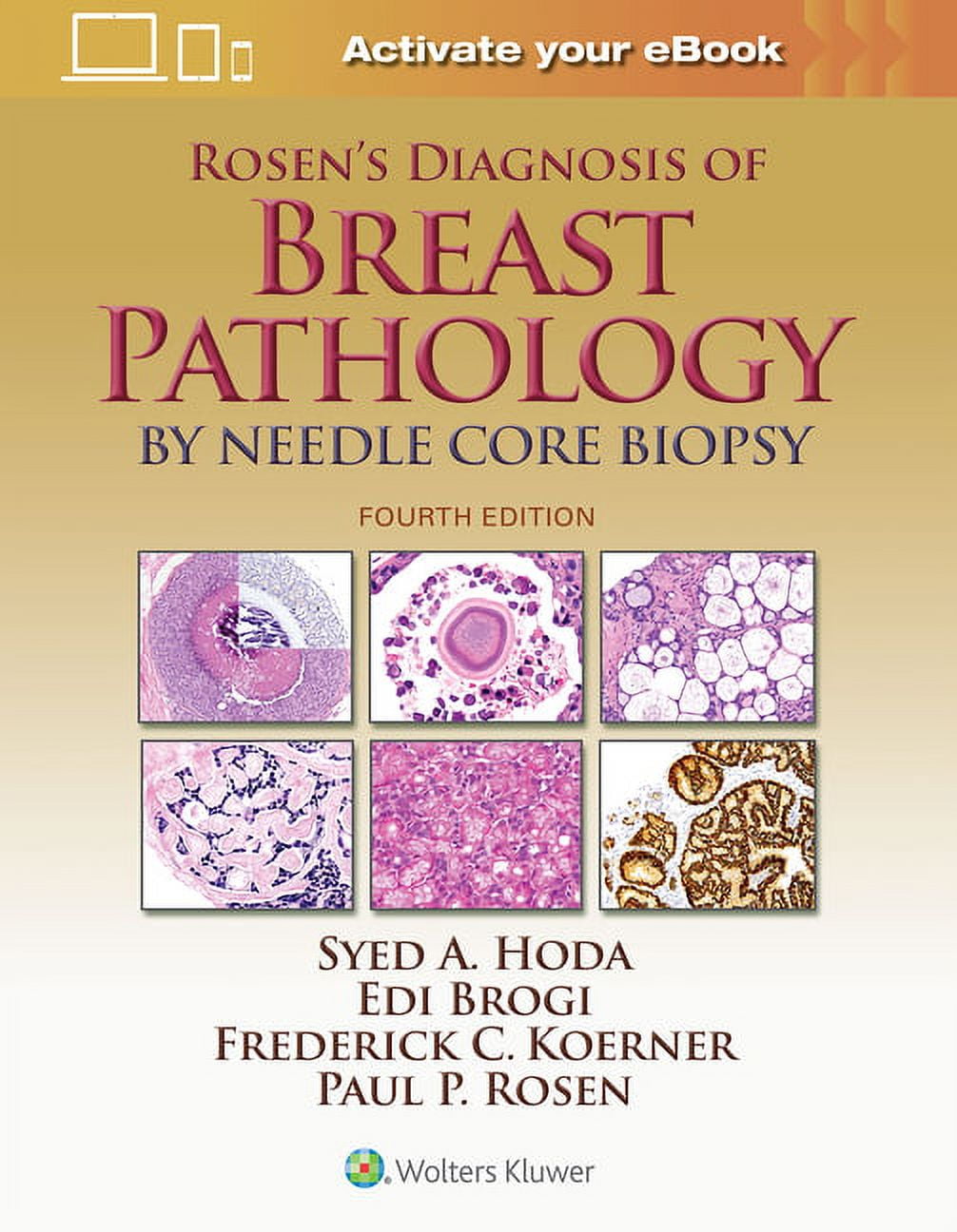 Rosen's Diagnosis of Breast Pathology by Needle Core Biopsy (Edition 4 ...
