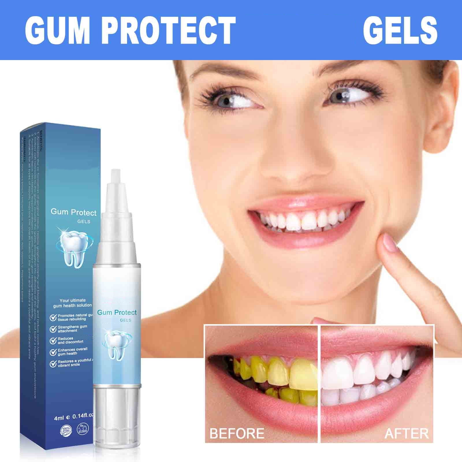 Rotary Tooth Whitening Pen, Teeth Whitener Stain Remover with Soft ...