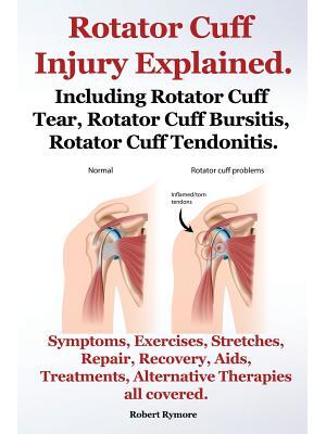 Rotator Cuff Injury Explained. Including Rotator Cuff Tear, Rotator ...
