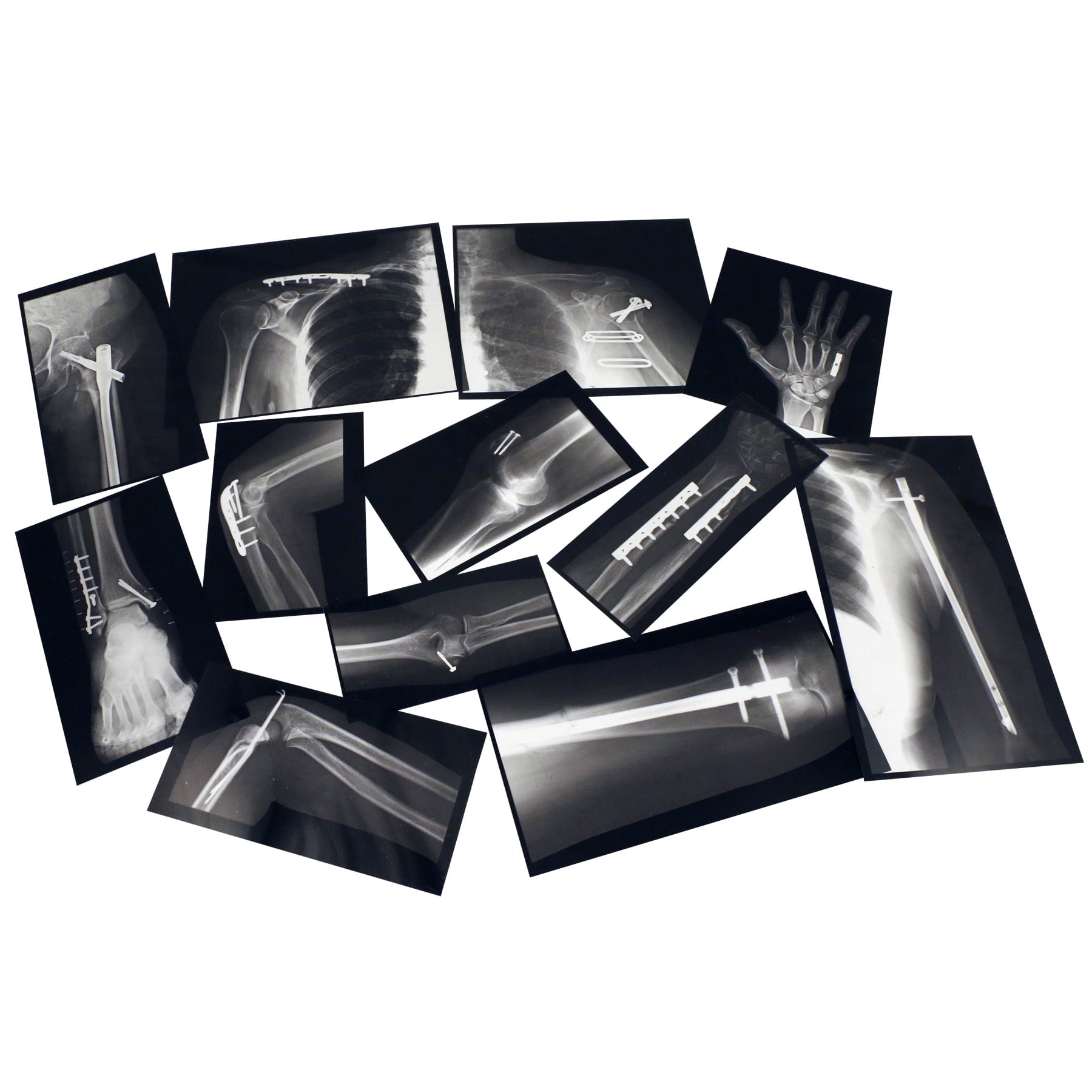 Roylco Fixed Bone X-Rays – Educational Human Anatomy X-Ray Set with ...