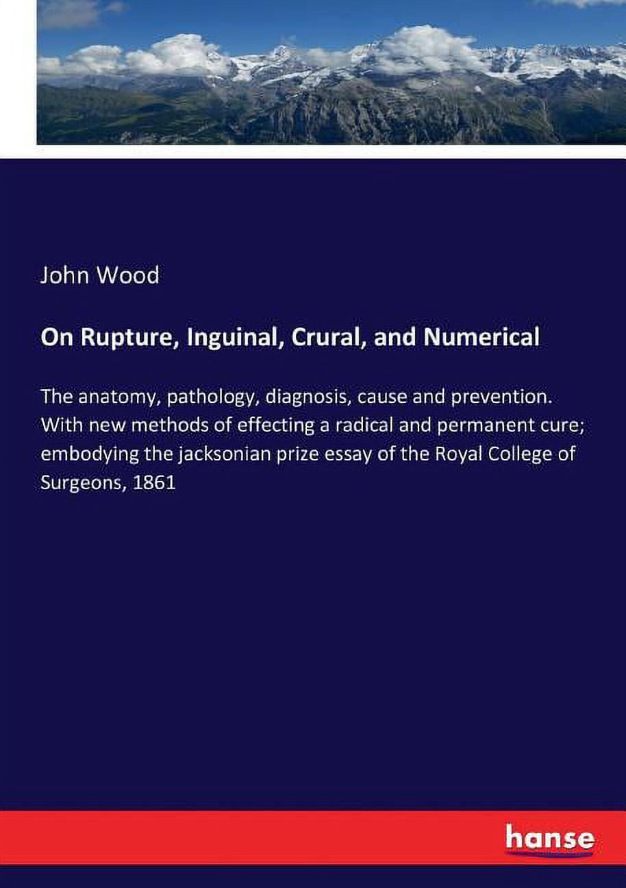 On Rupture, Inguinal, Crural, and Numerical : The anatomy, pathology ...