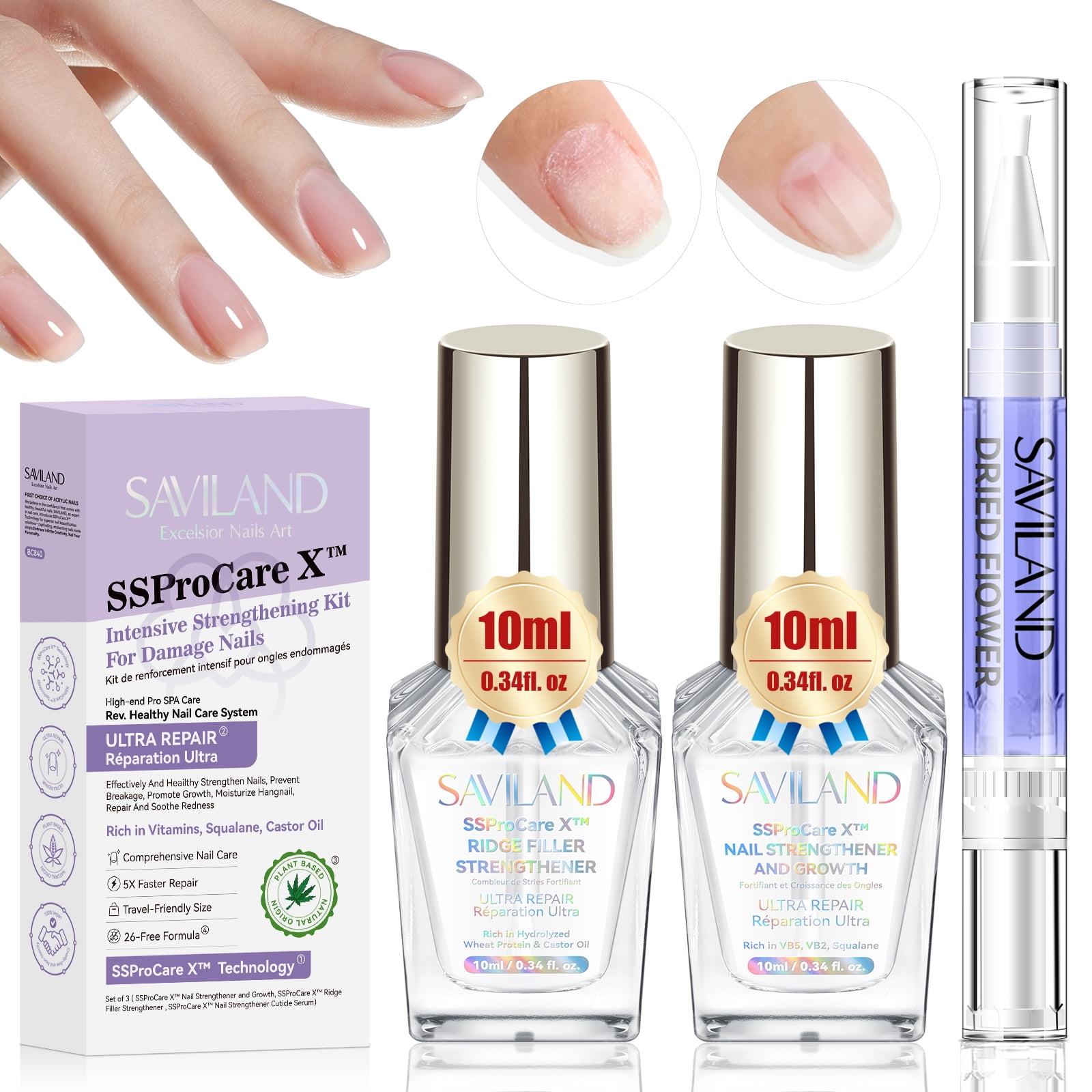 Customer reviews for SAVILAND 3-in-1 Nail Strengthener Kit: Ultra ...