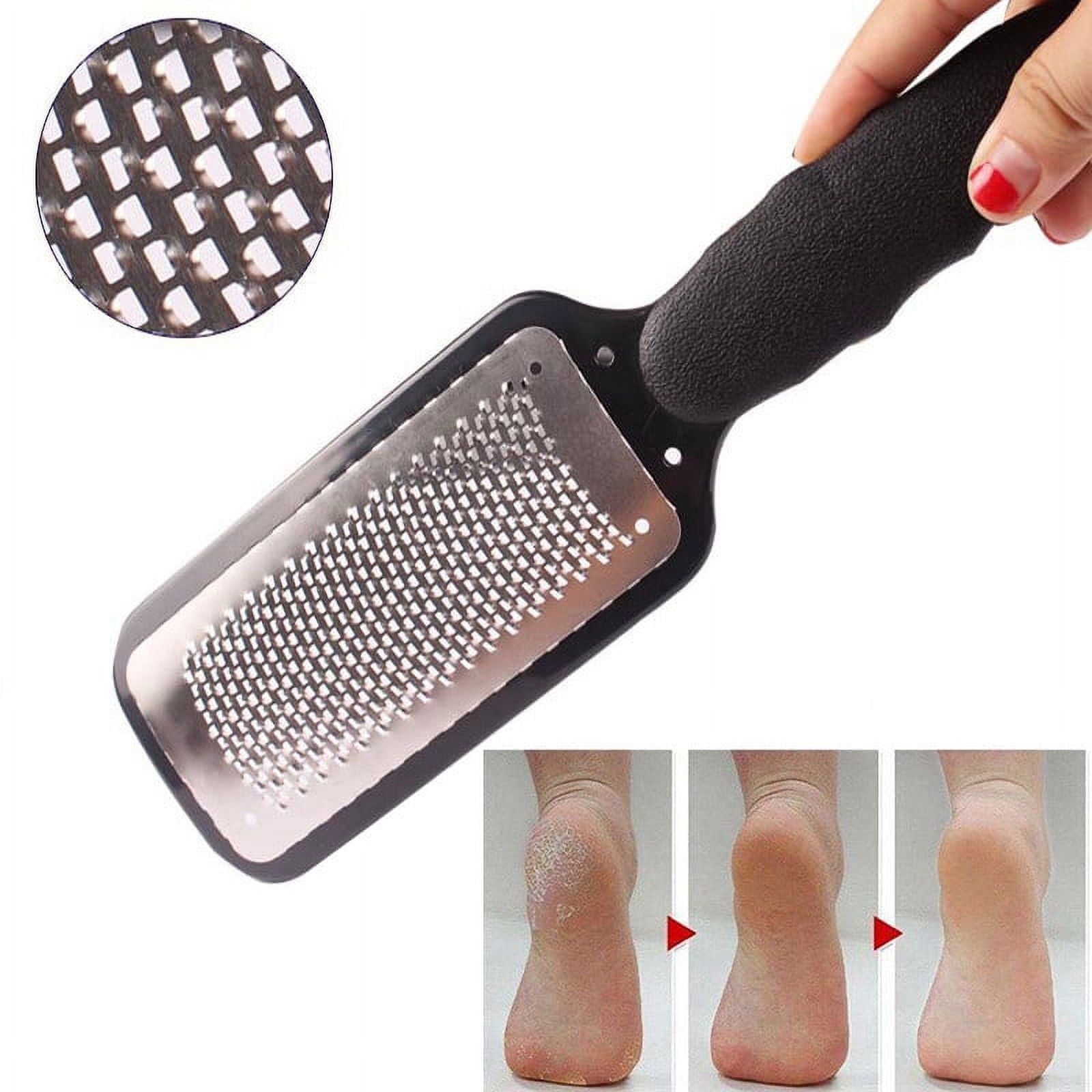 SDJMa Colossal Foot rasp Foot File and Callus Remover. Best Foot Care ...