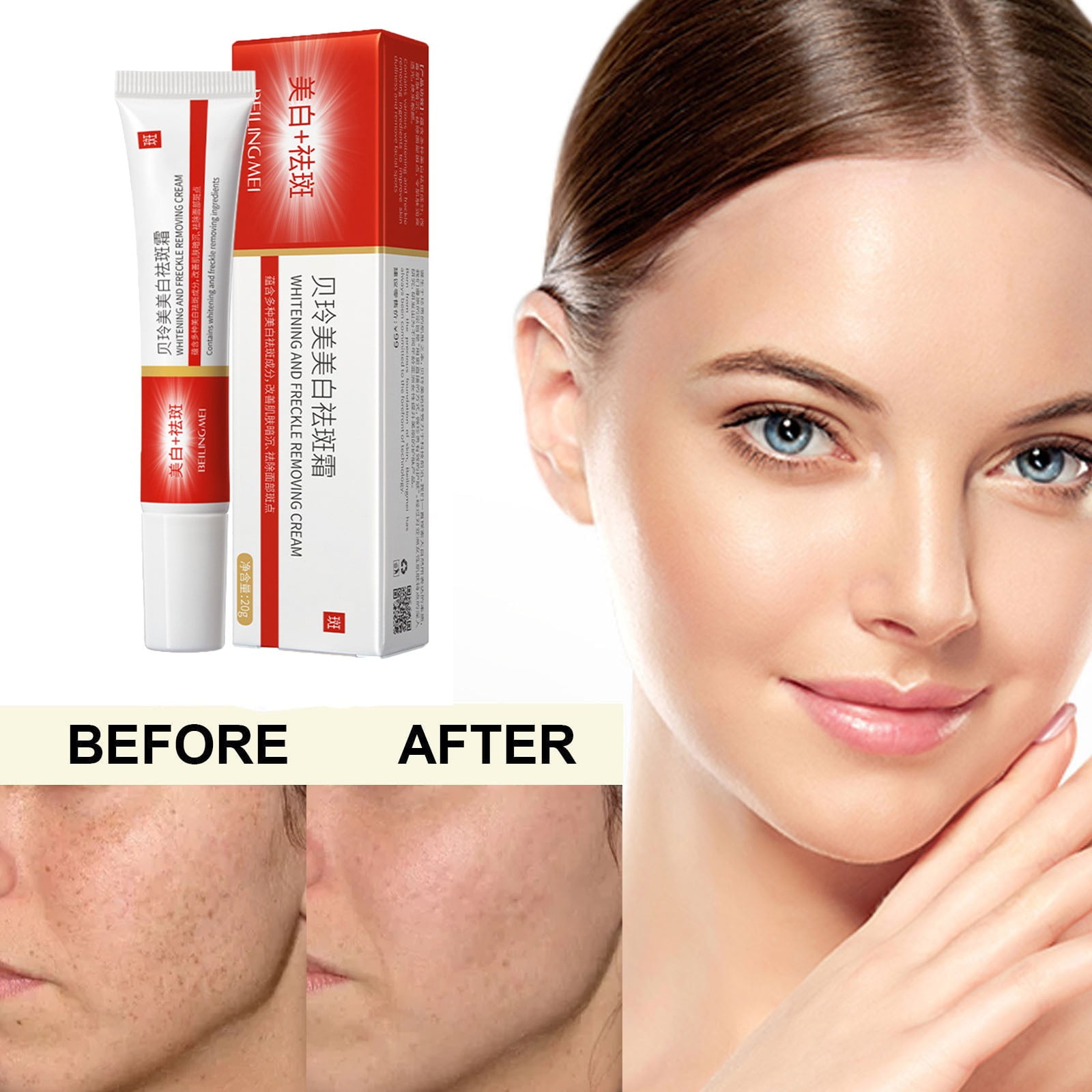 SDOHIG Facial Moisturizer, Spot Removing Cream, Face Moisturizer for Women and Men, Moisturizer ...