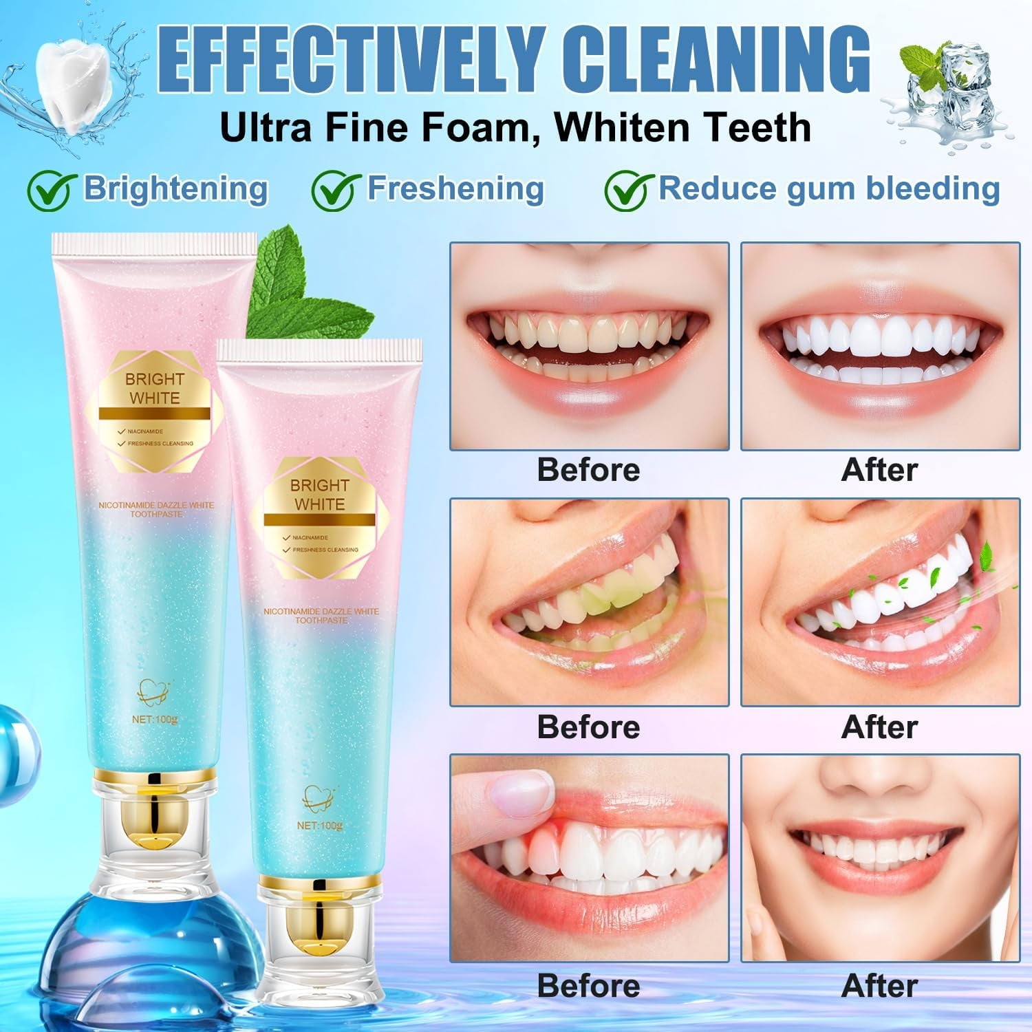 SHUDON Niacinamide Whitening Toothpaste, 100 g Natural Whitening ...