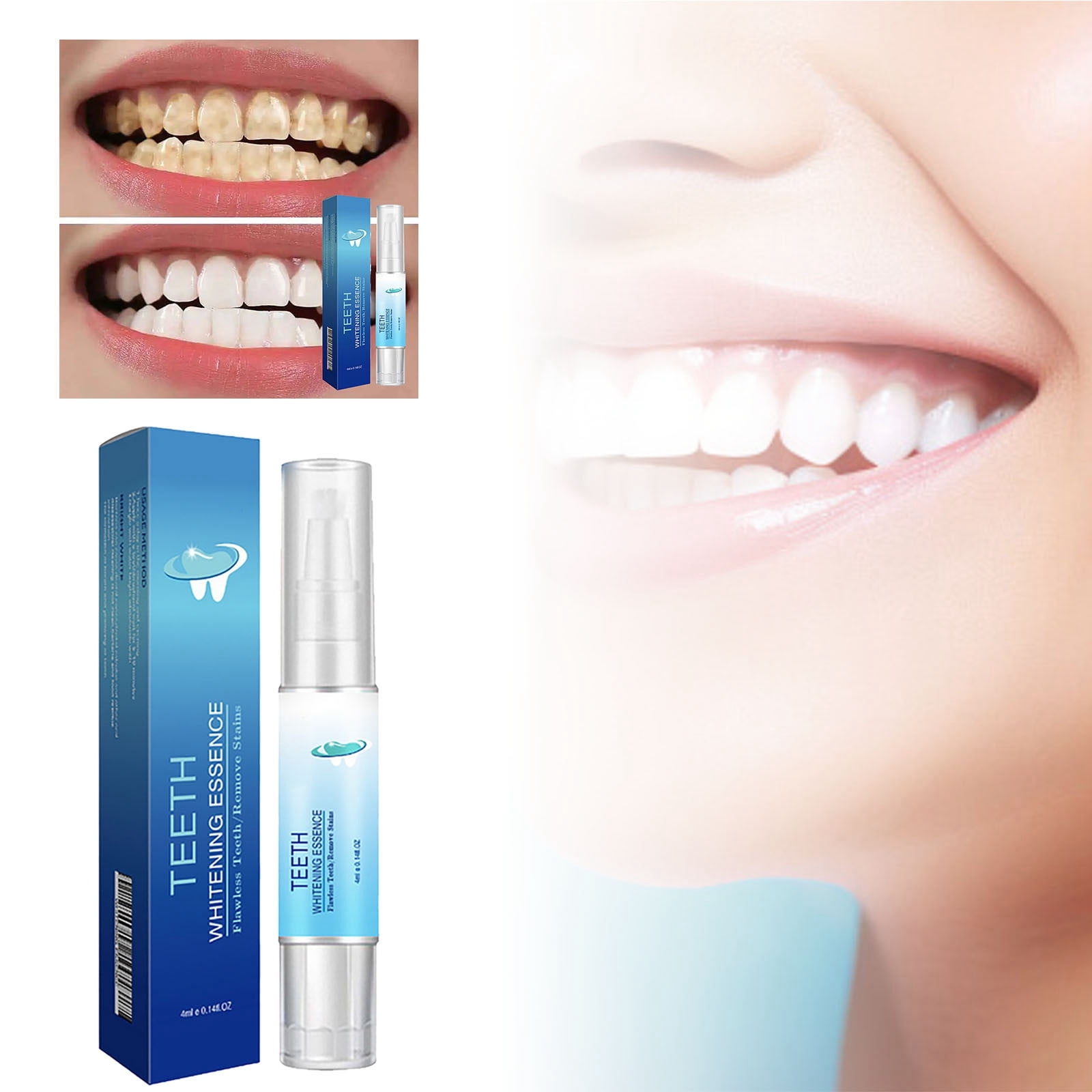 SJXHJH Teeth Pen Instant Gel for Whiter Teeth Easy To Use Enamel Travel ...