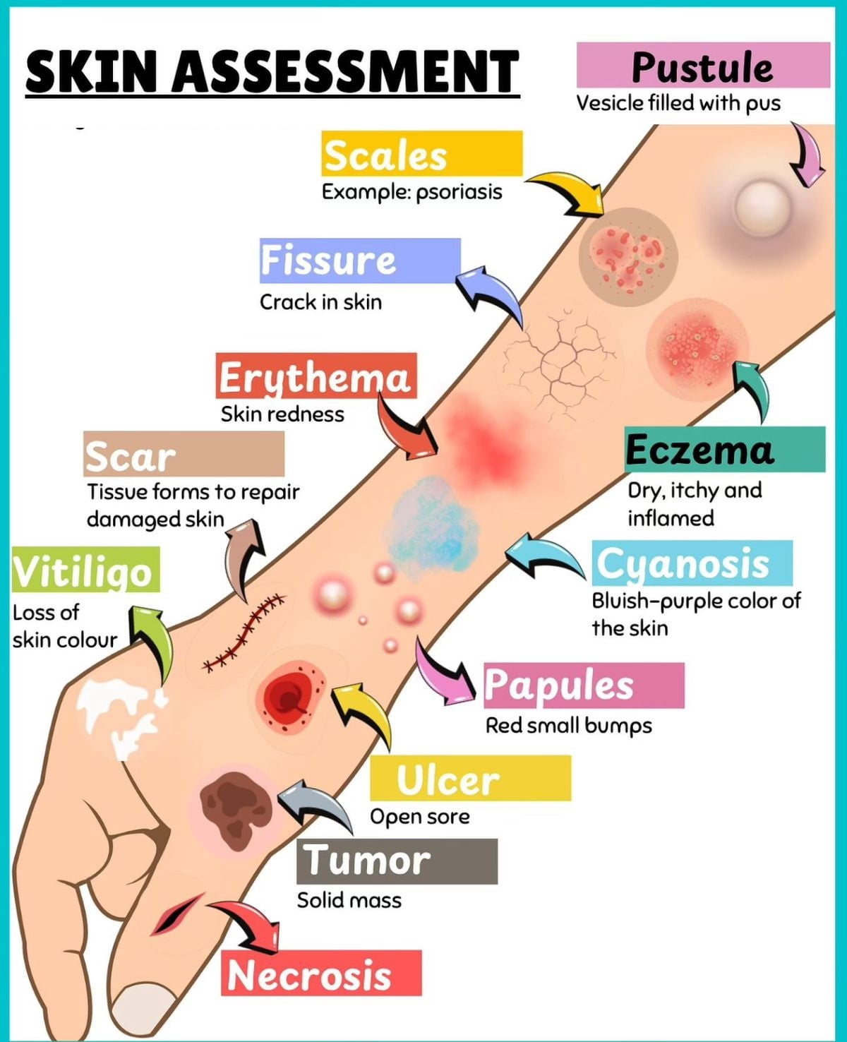 SKIN ASSESSMENT Poster Suitable for medical education posters for ...