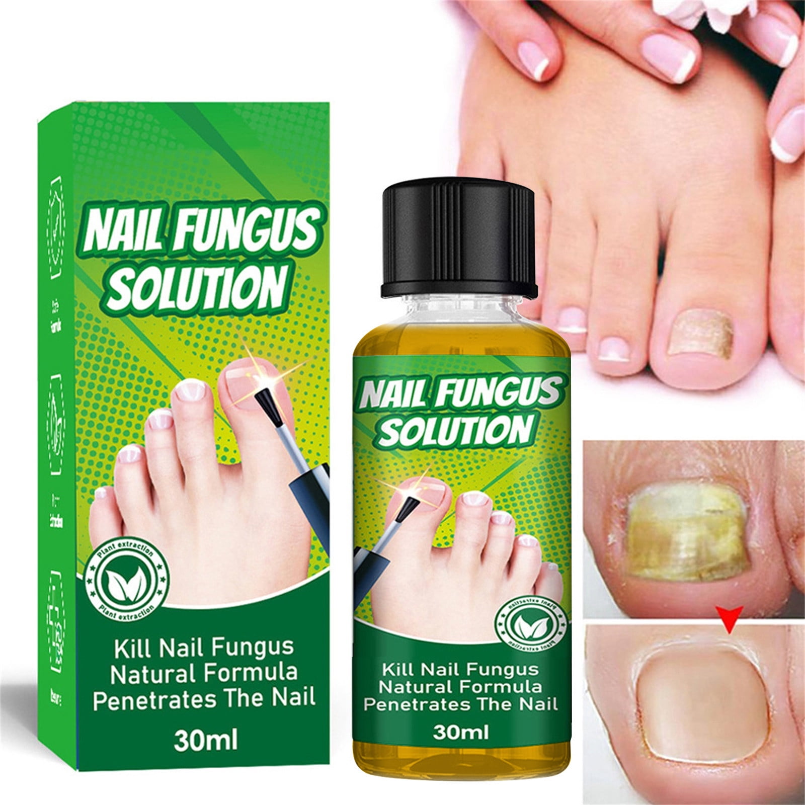Damaged Toenail Treatment: How To Fix Toenail Tears – DYKOT