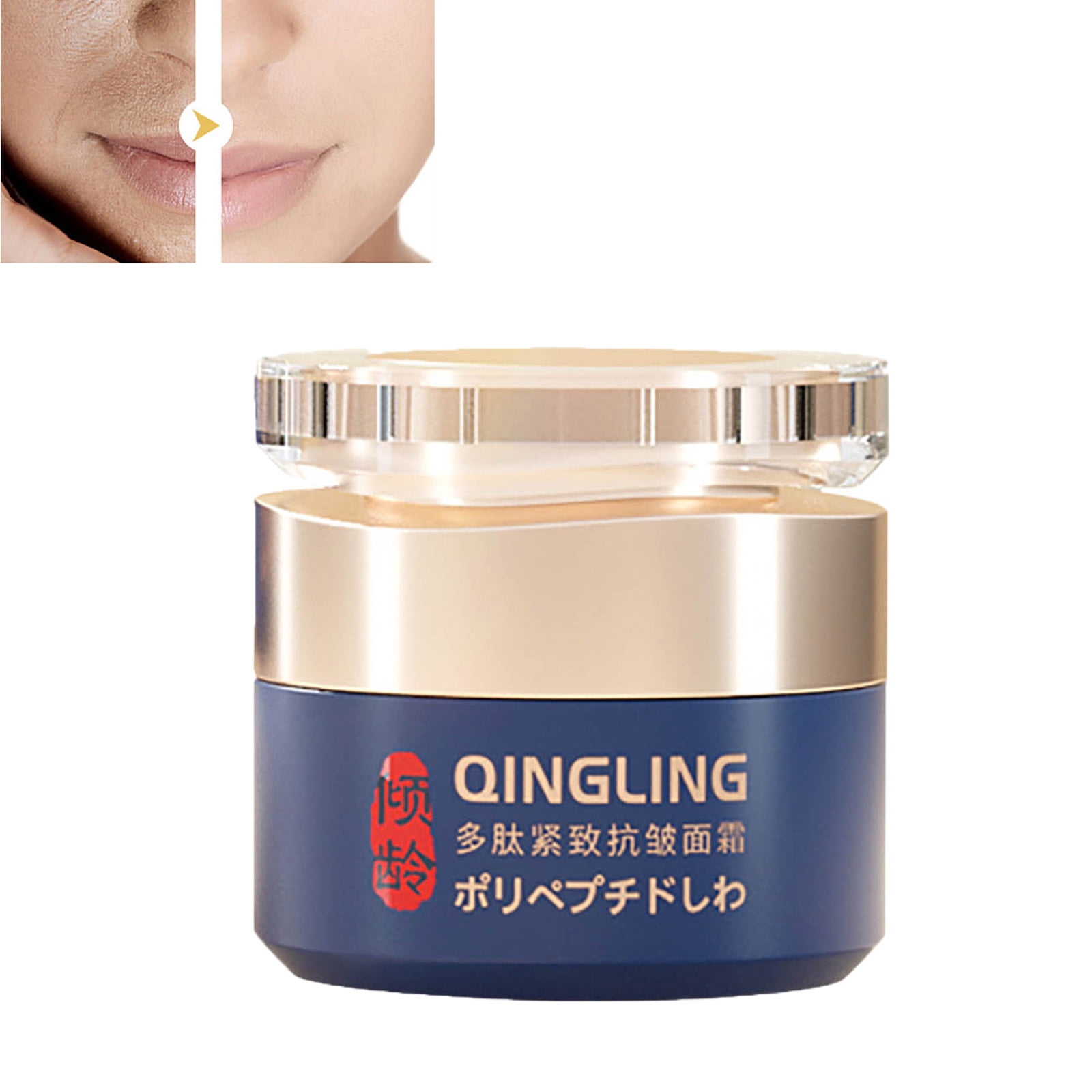 STARLAN Qingling Wrinkle Removal Cream, Qinglin Wrinkle Remover Cream ...