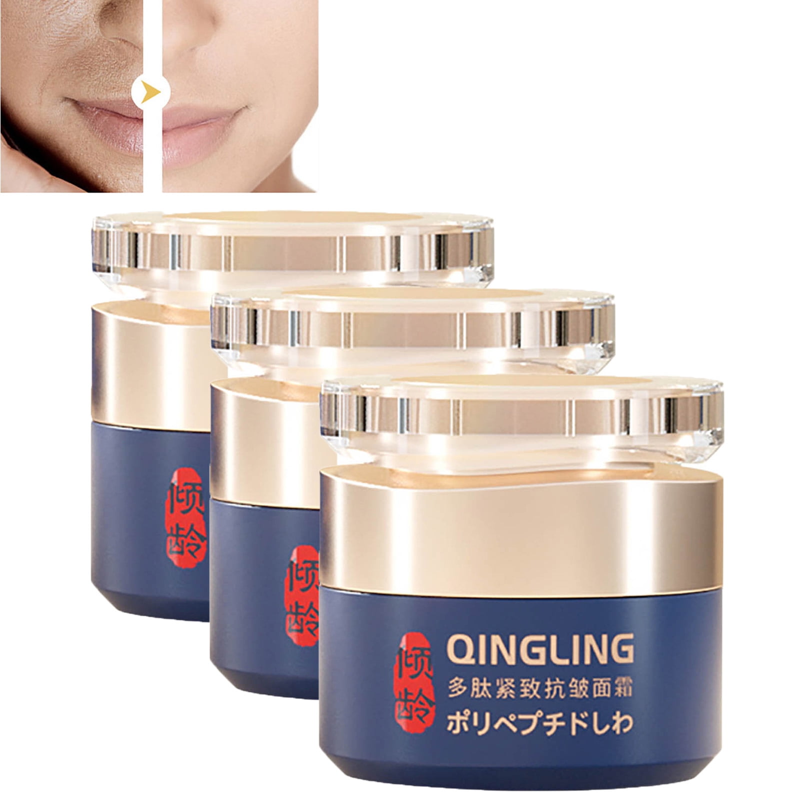 STARLAN Qingling Wrinkle Removal Cream, Qinglin Wrinkle Remover Cream for Face, Anti Aging ...