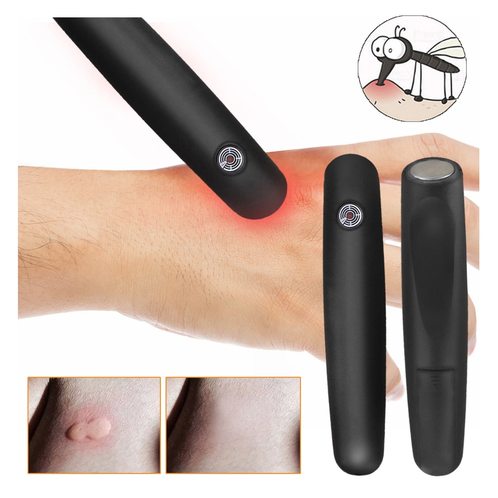 SUMDUINO Anti-Itch,Antipruritic Stick Portable Insect Removal ...