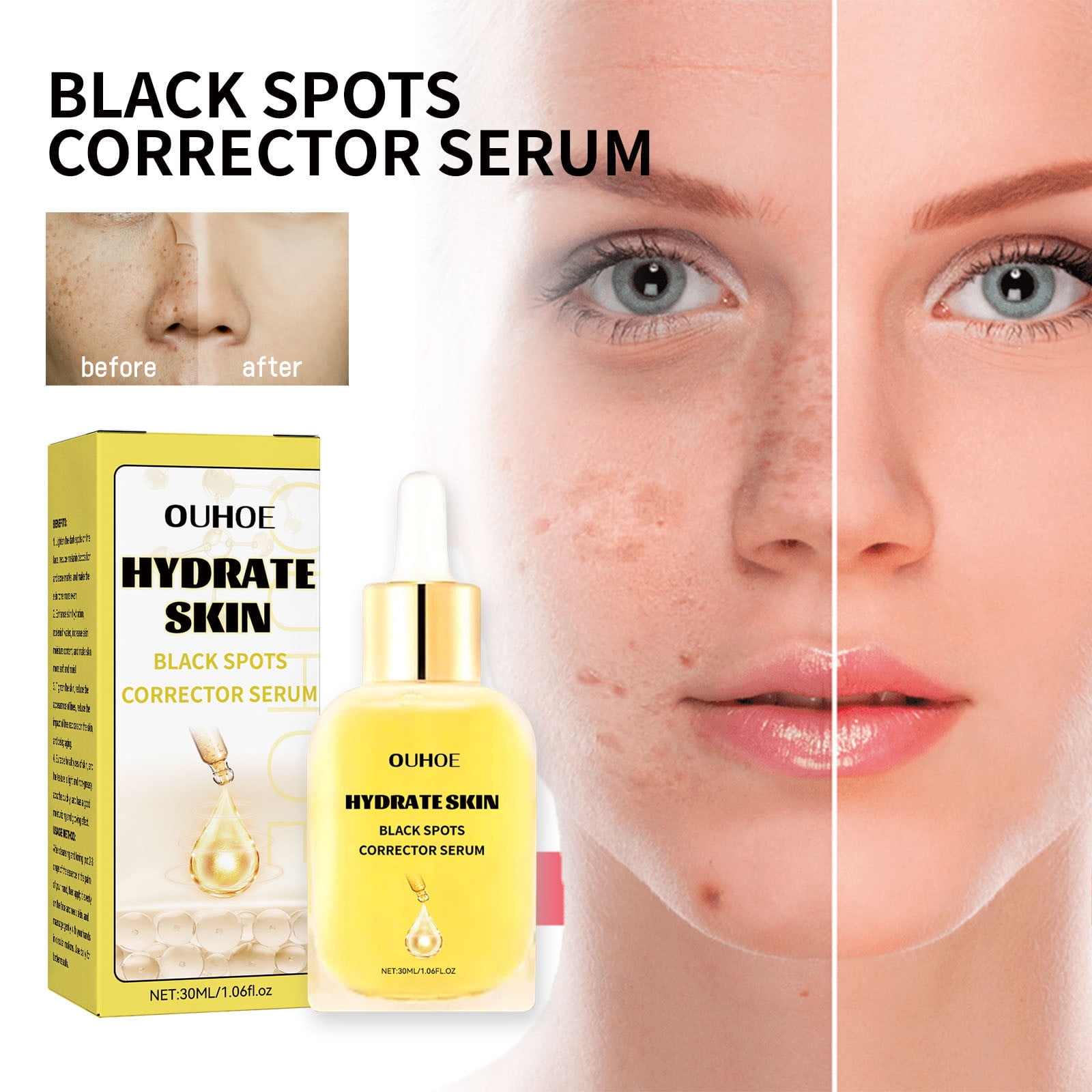 SUMDUINO Clear Improve Skin Spray, Fade Black Spots Repair Elbow Knee ...