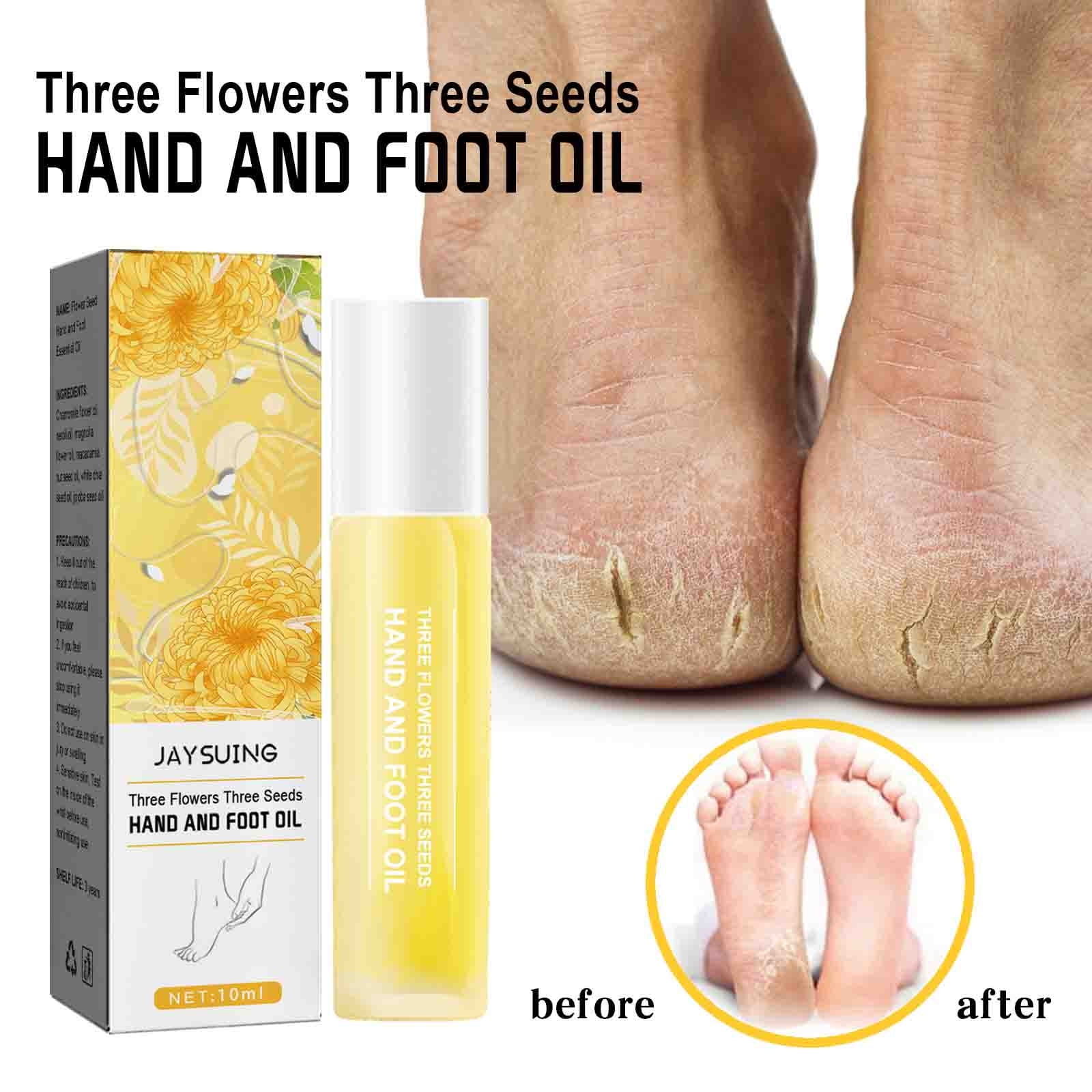 SUMDUINO Three Flowers Hand And Foot Essential Oil Repairs Chapped, Dry ...