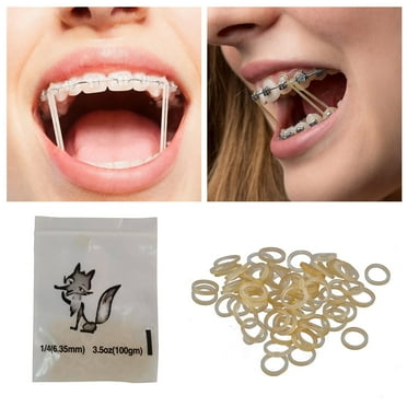 Sparco High Quality Box Rubber Bands - Walmart.com