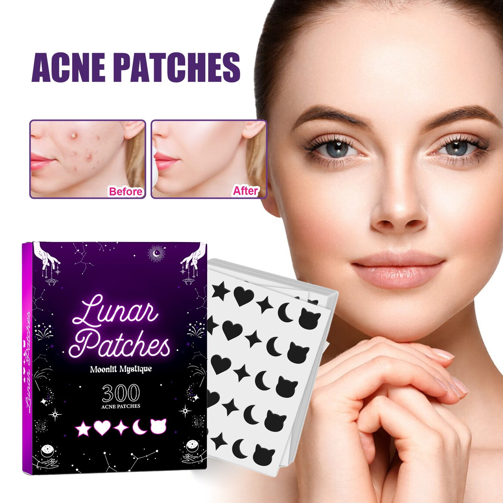 SYS Patch 300pc Fades Skin Flaws Covering Patch - Walmart.com