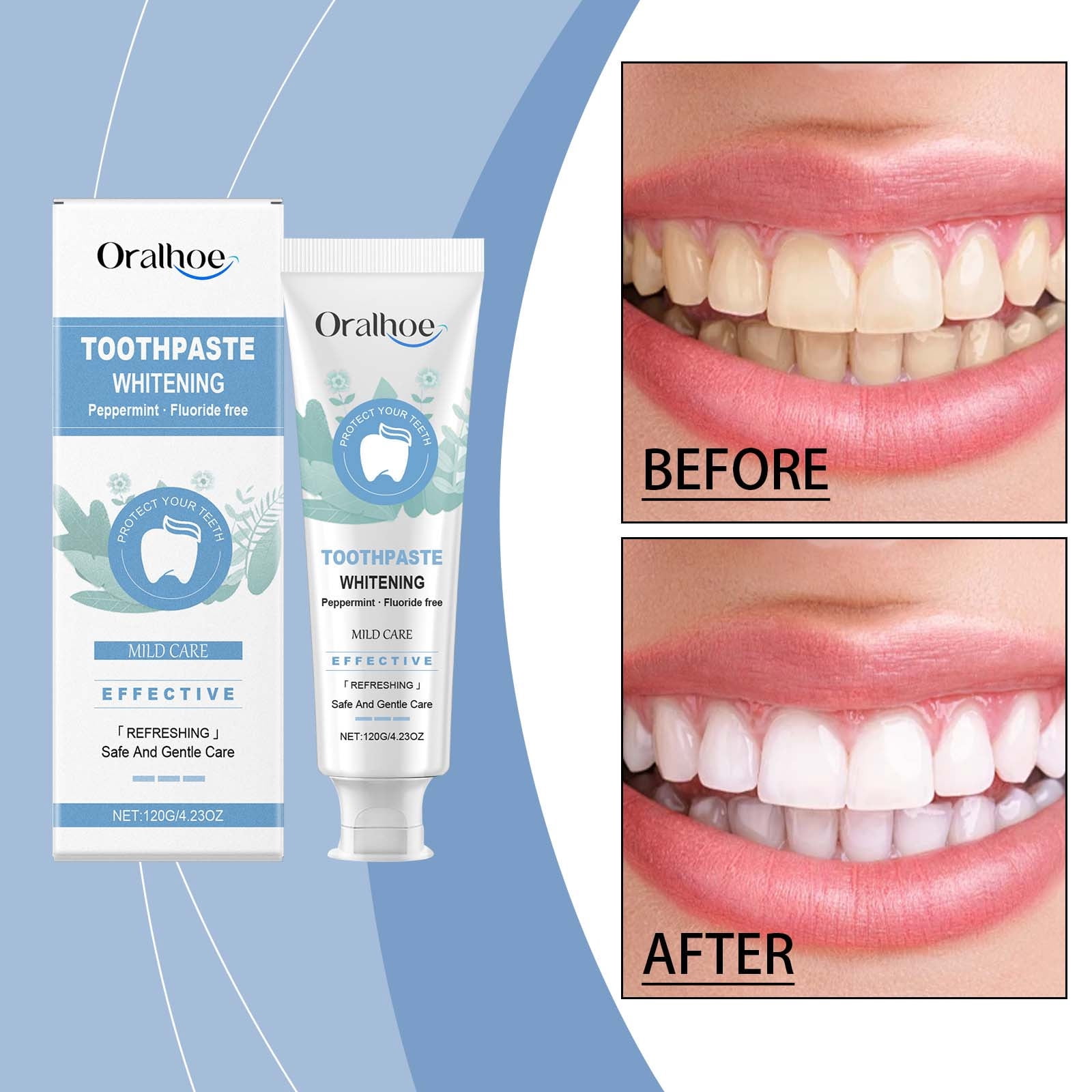 Safe Gums Toothpaste 120g - Freshens Breath,Prevents Tooth Decay ...