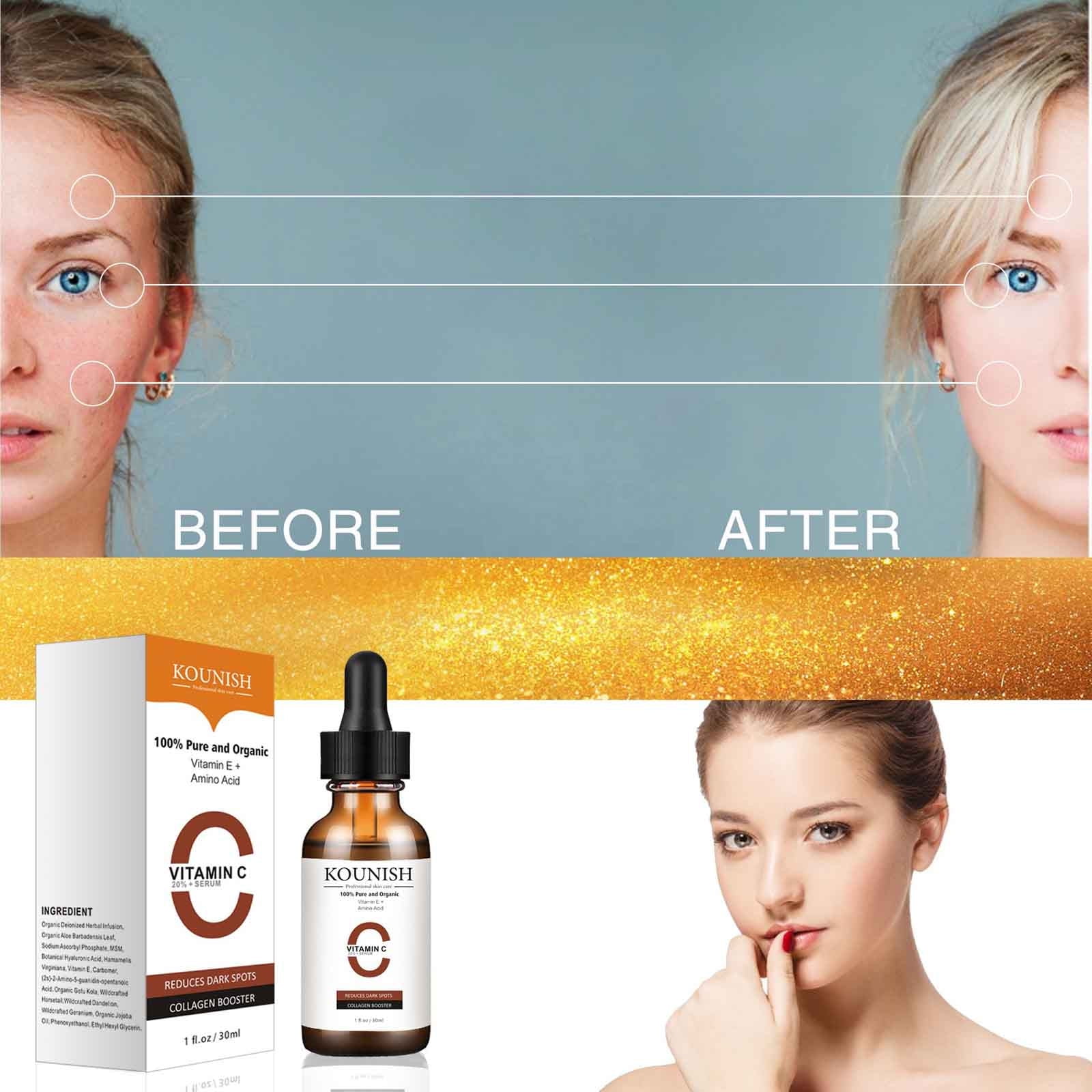 Sale Today Clearance! Vitamin C Brightening Serum – 30ml Facial Serum ...