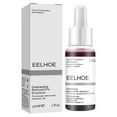 Salicylic Acid Face Serumacne Treatment Clearing Gel For Blackheads Zits Oily Skin Dark Spot