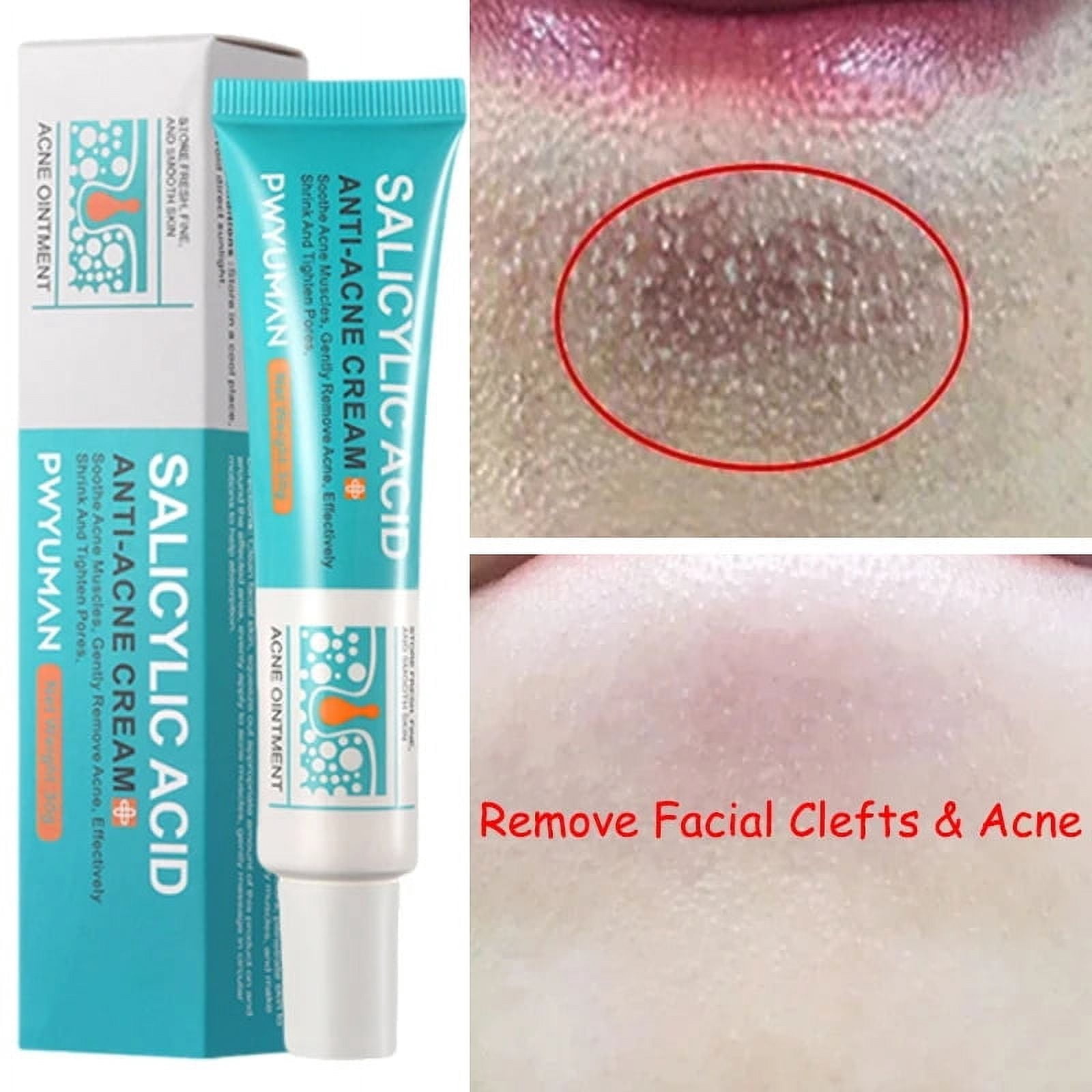 Salicylic Acid Pore Shrinking Cream Quick Eliminate Large Pores Remove ...