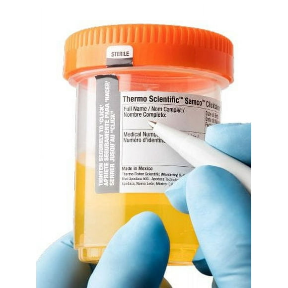 Sterile Specimen Cup