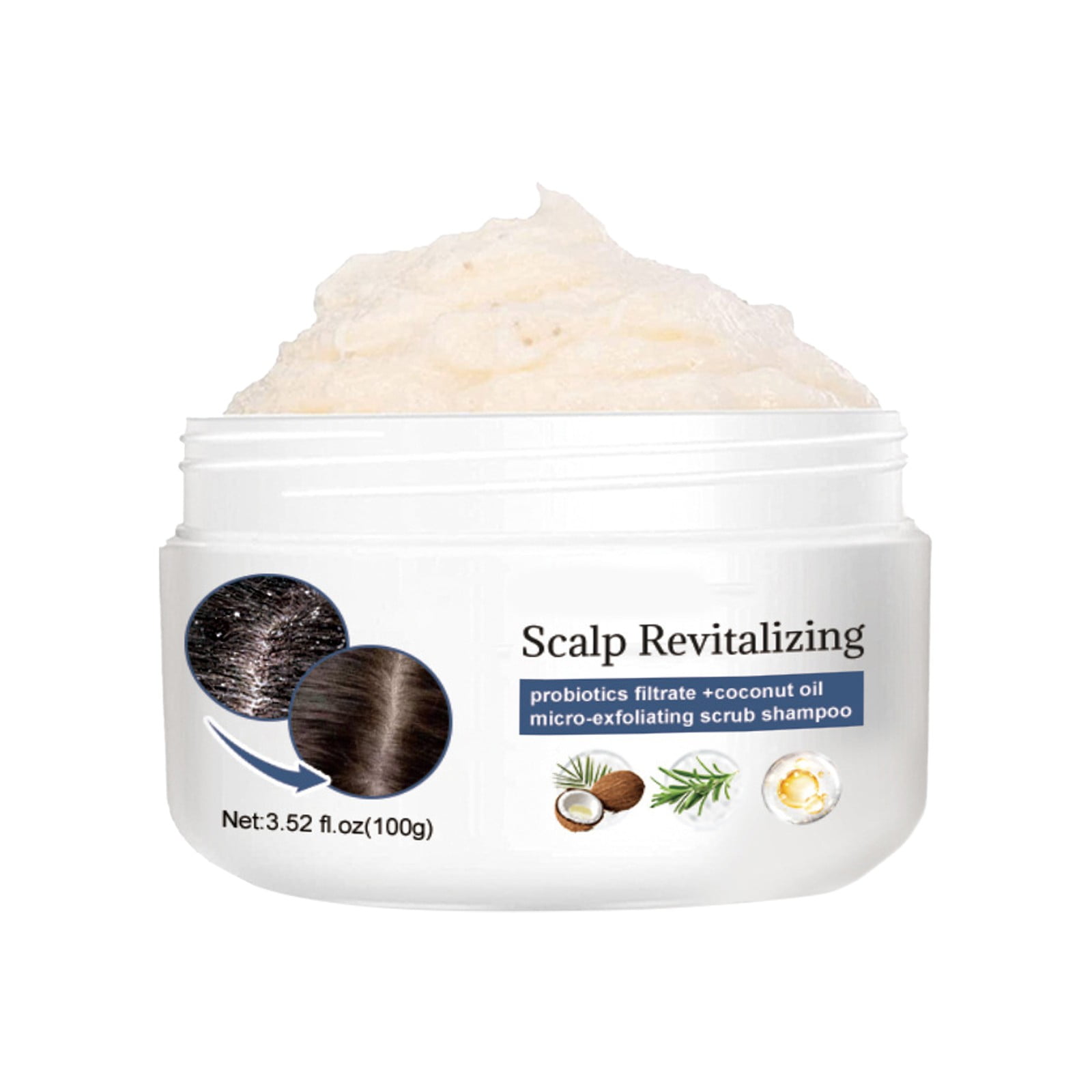 Scalp Exfoliating Scrub Moisturizing Dry Hair Scalp Cleansing Care ...
