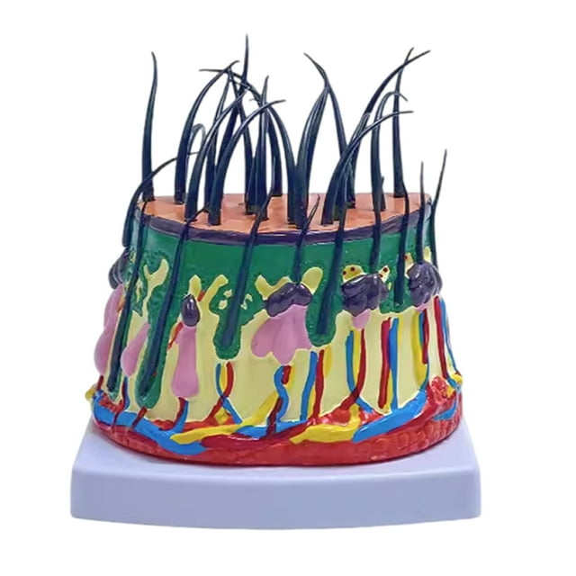Scalp Model 50X Enlarged Anatomical Scalp Layer Structure Model for ...