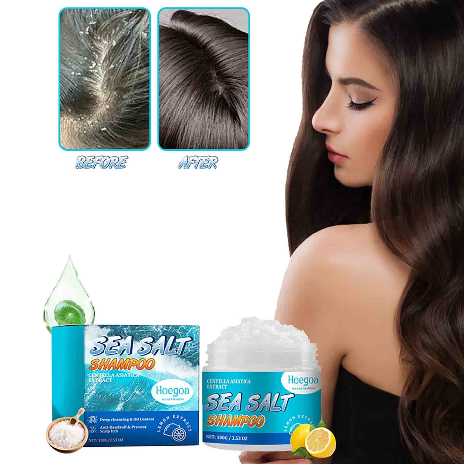 Scalp Soothing Hydrating Sea Shampoo, Anti-Dandruff, Itch Relief ...