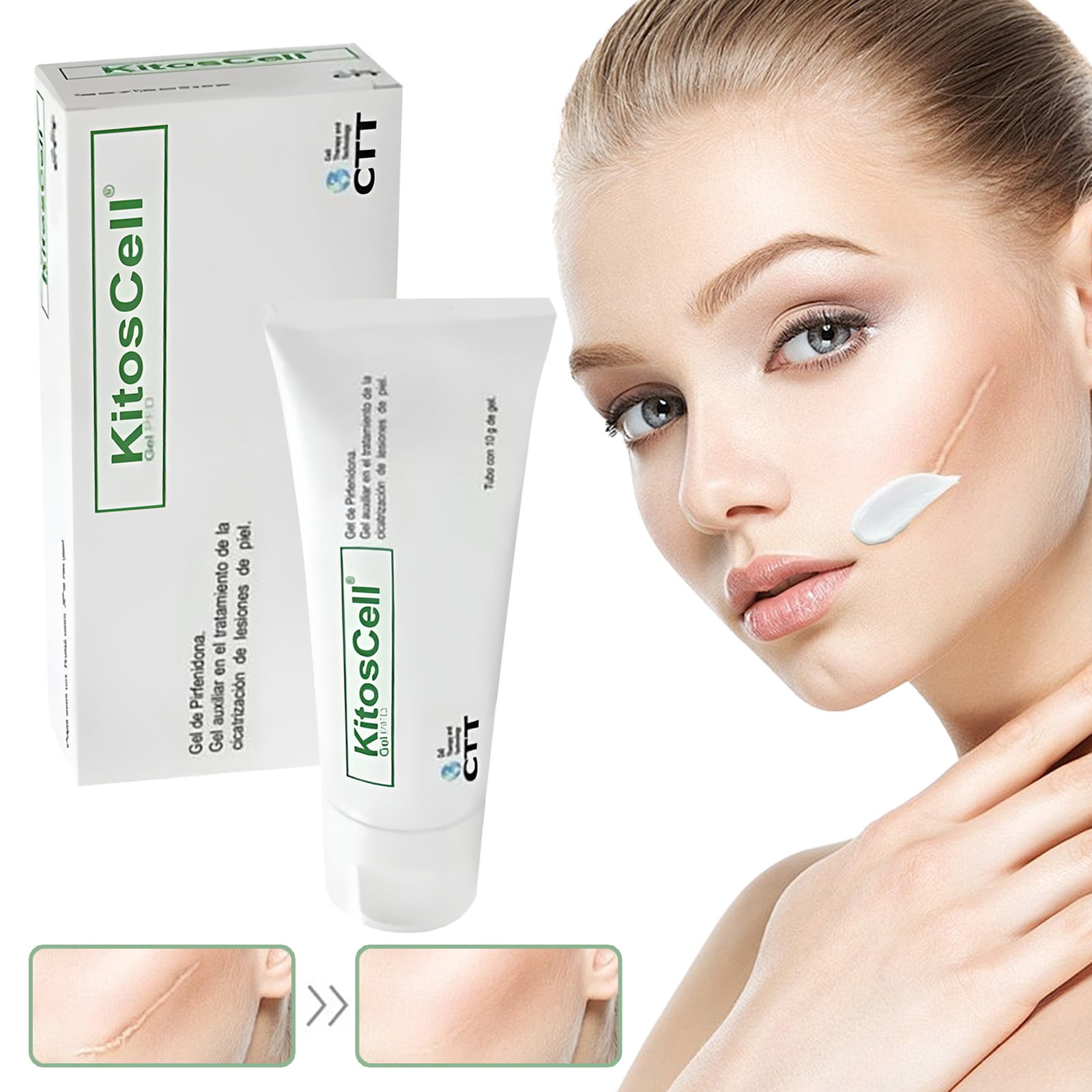 Scar Cream,1 Pack Kitos Cell Gel 10g Expression Lines,Skin Regeneration ...