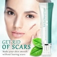 Scar Cream Advanced Scar Gel Silicone Scar Gel Scar Removal Cream
