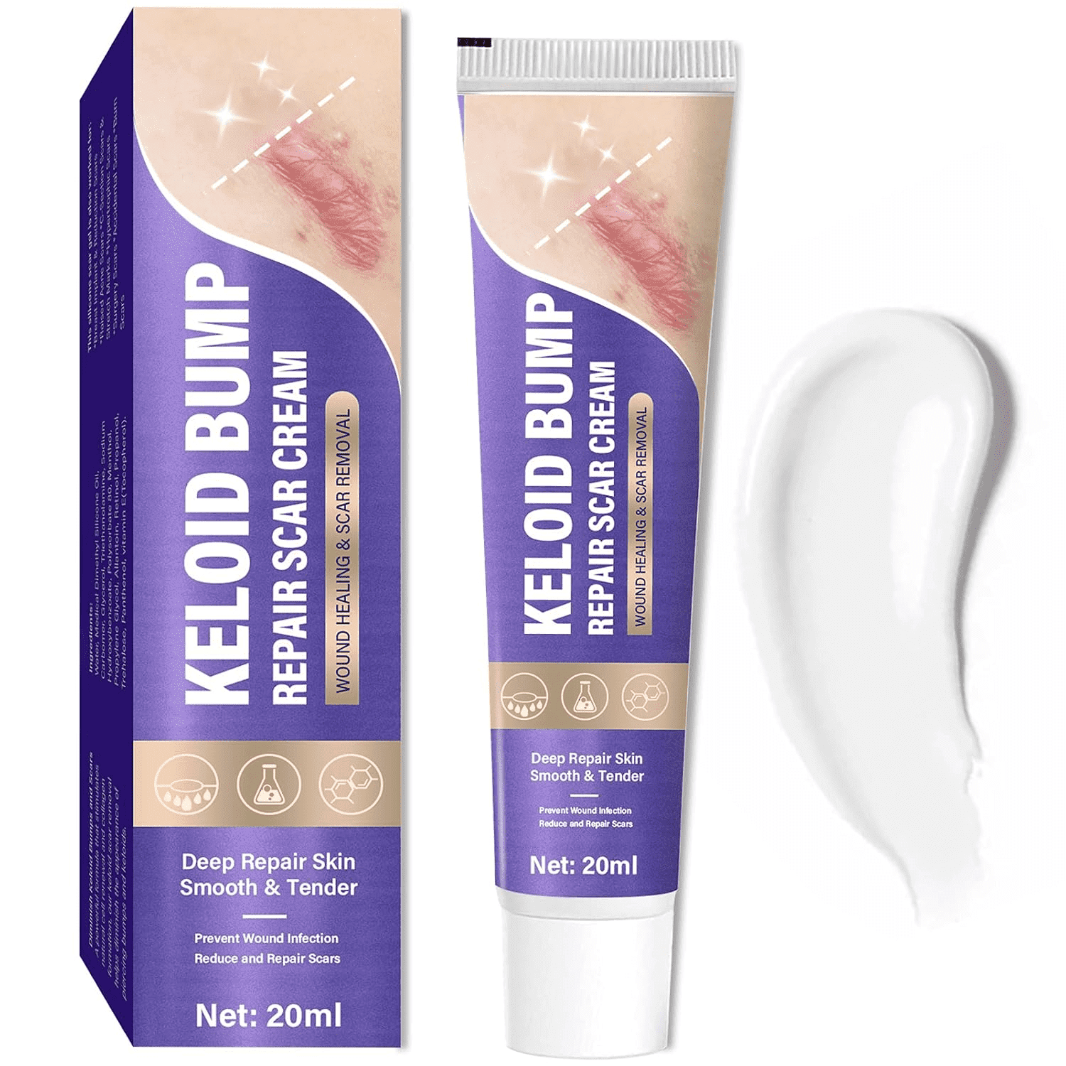 Scar Cream For Surgical Scars, Keloid Bump Removal, Keloid Scar ...
