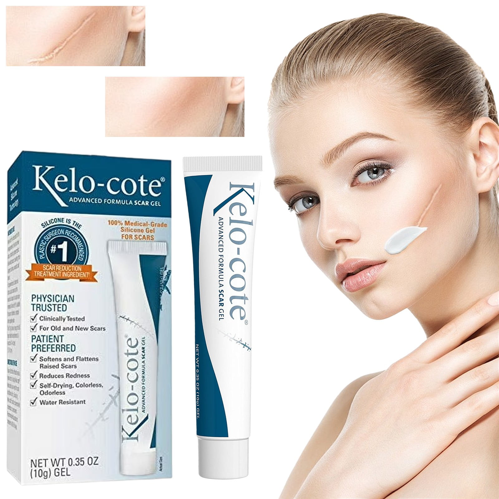 Scar Cream,Keloid Bump Removal,Scar Away High Grade Formula Scar Scar ...