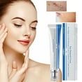 Scar Gel Scar Smoothing Skin Gel Advanced Scar Moisturizing Nourishing ...