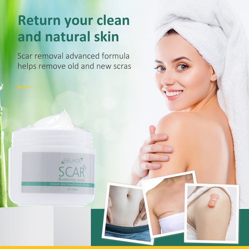 Scar Removal Cream For Old Scars, Stretch marks Scar Gel Treatment, Face Acne Scar Cream for Men ...