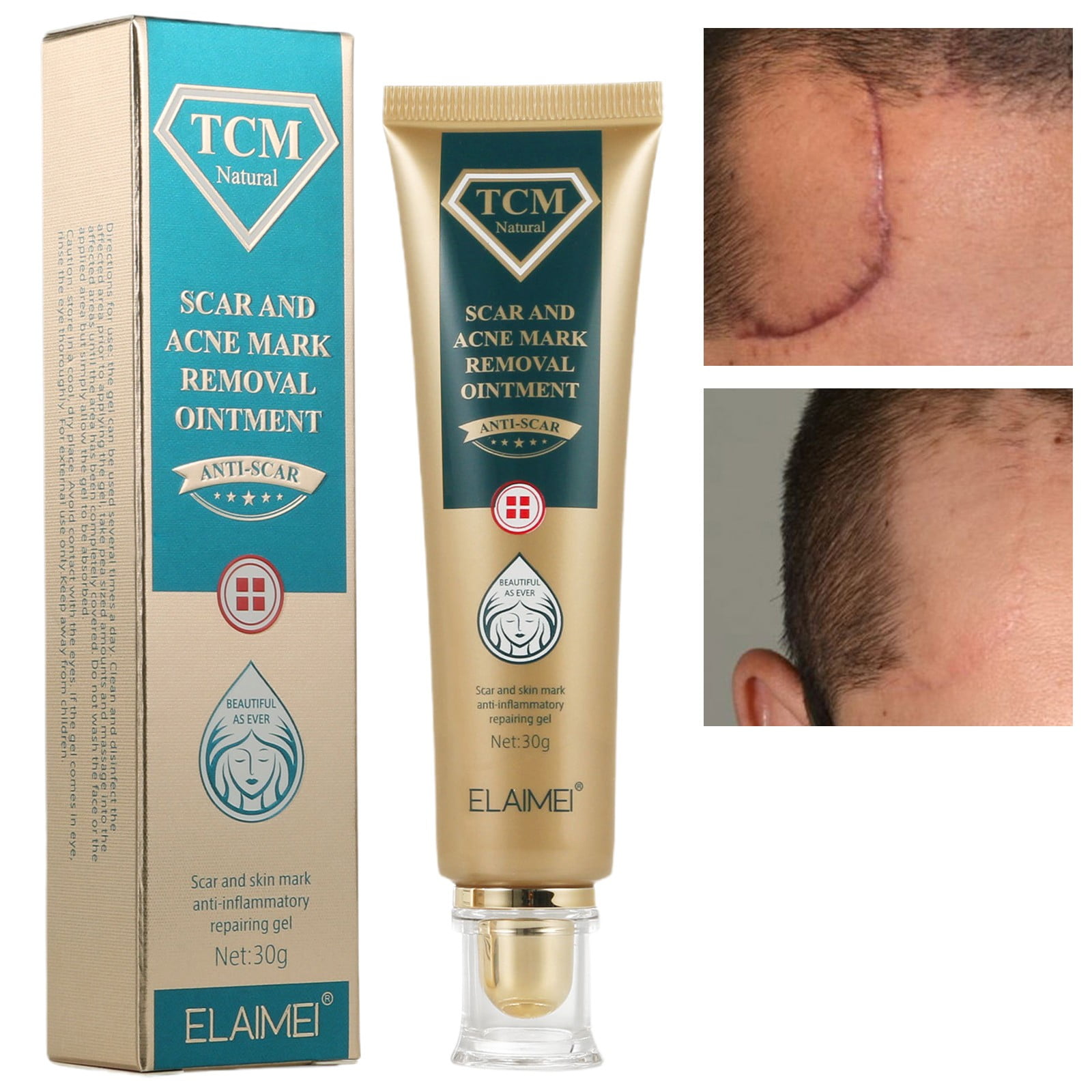 Scar Removal Gel for Old and New Scars, Natural Formula for Reducing ...