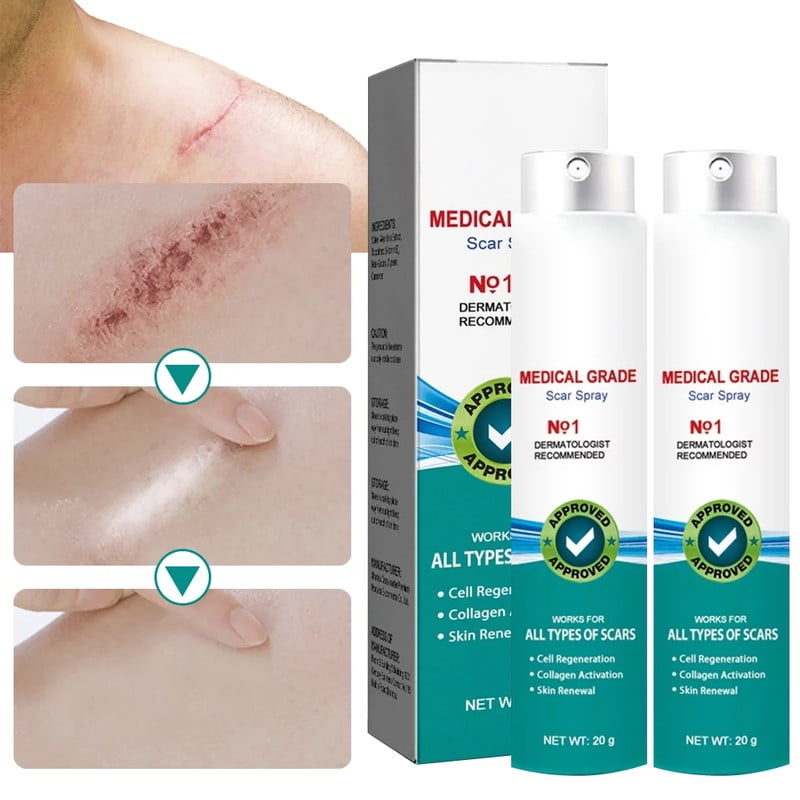Scar Removal Professional Medical Grade Spray, Pregnant Women Stretch ...
