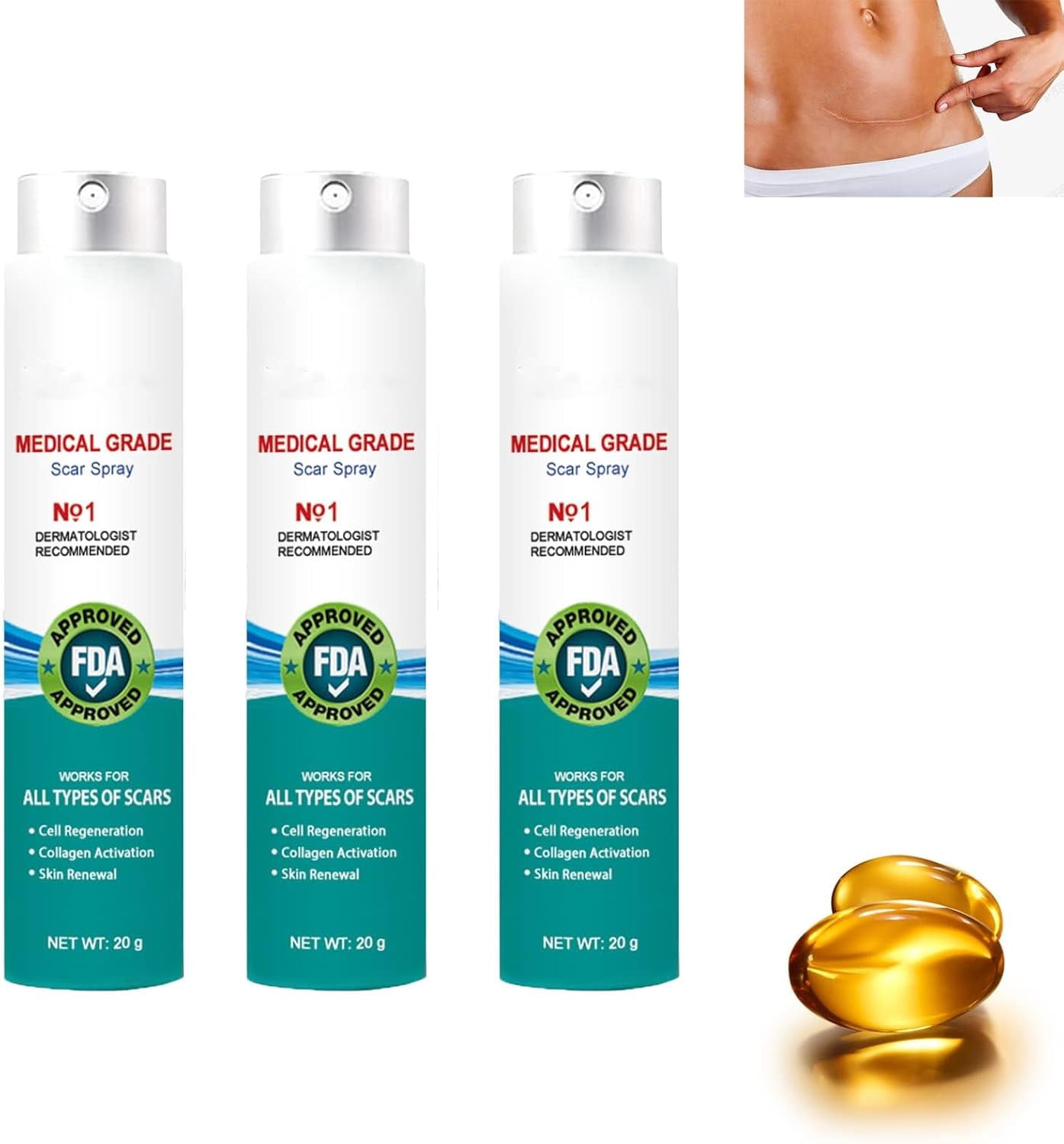 Scar Remove,Scar Remove Medical Grade Scar Spray,Medical Grade Scar ...