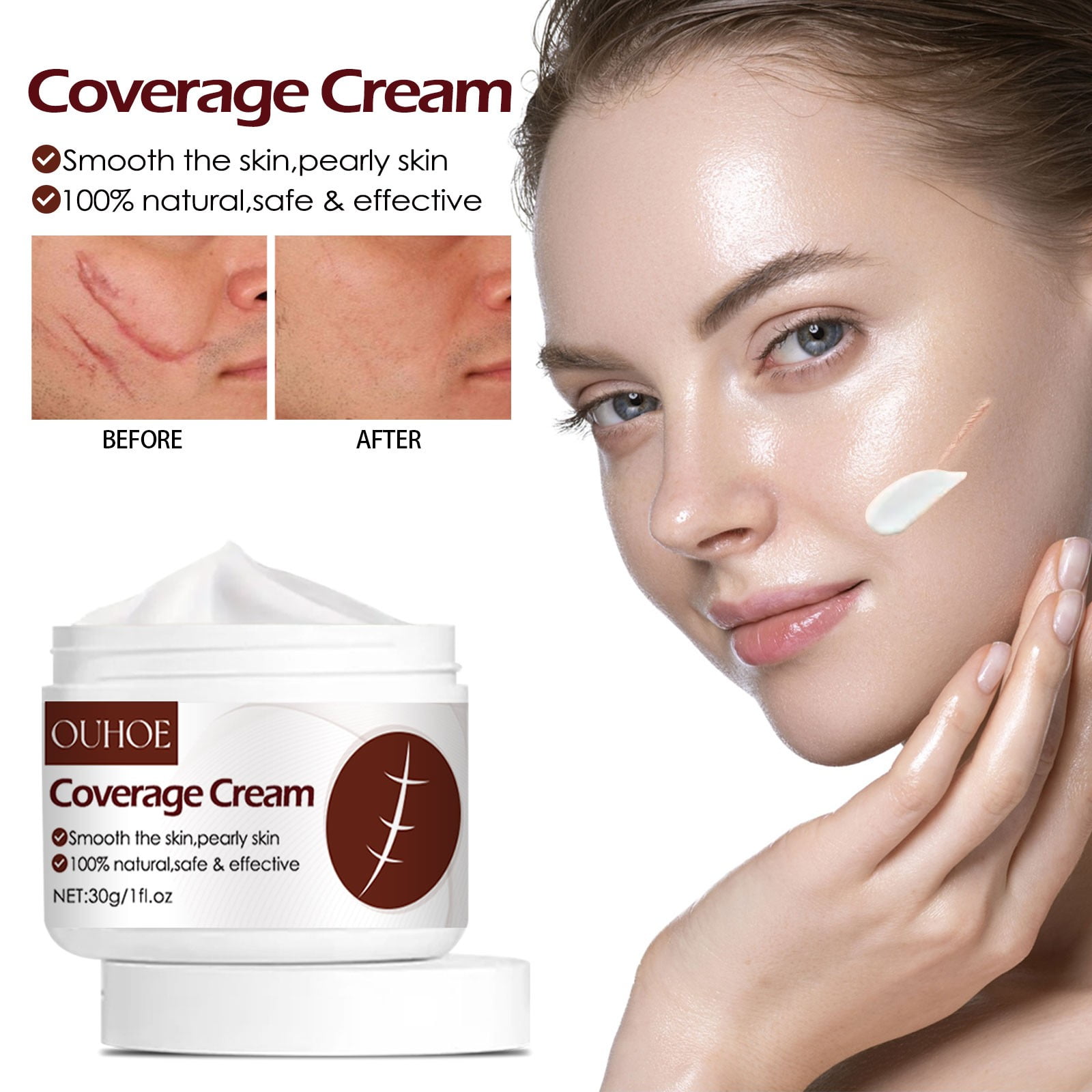 Scar Repair Cream, Dilute Cesarean Scar, Burn Scar Treatment, Surgical ...