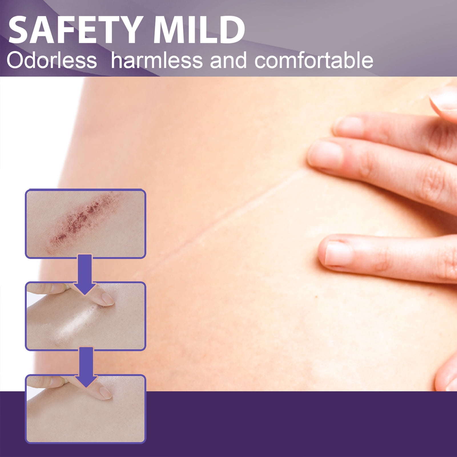 Scar Sheet,Silicone Scar New Uteam Mild Odorless Scar Sheet Scars Old ...