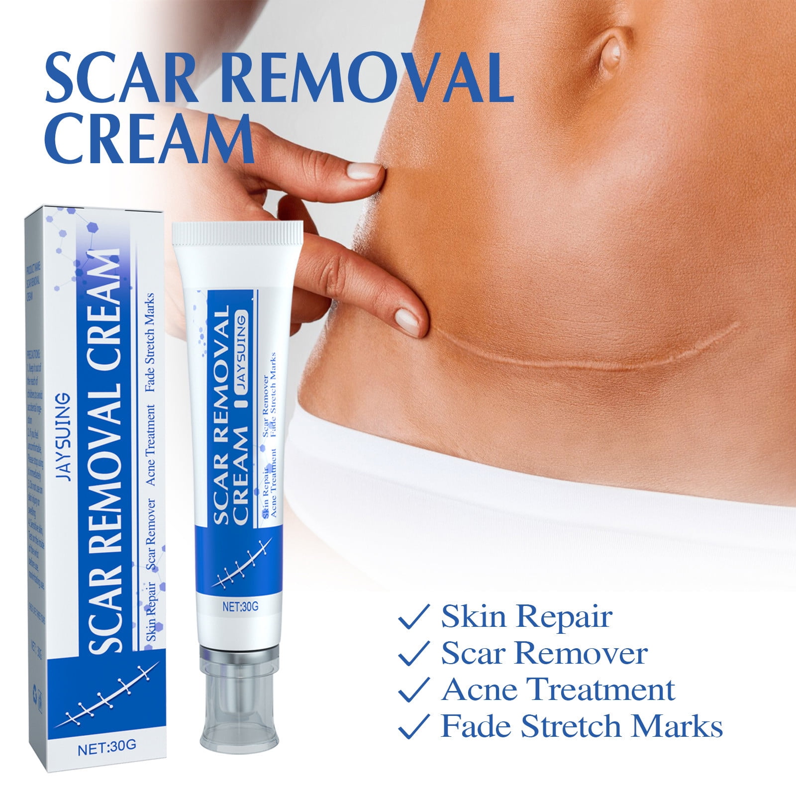 Scar and Acne Marks Removal Ointment Gel, Scar Removal Cream, Skin Repair Scars Burns Cuts ...