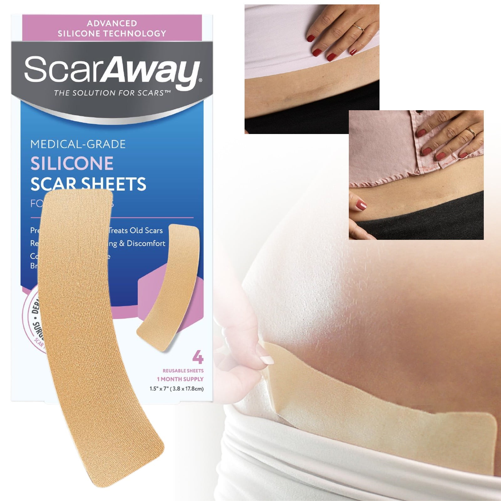 ScarAway Advanced Skincare Silicone Scar Sheets for C-Section, Reusable ...
