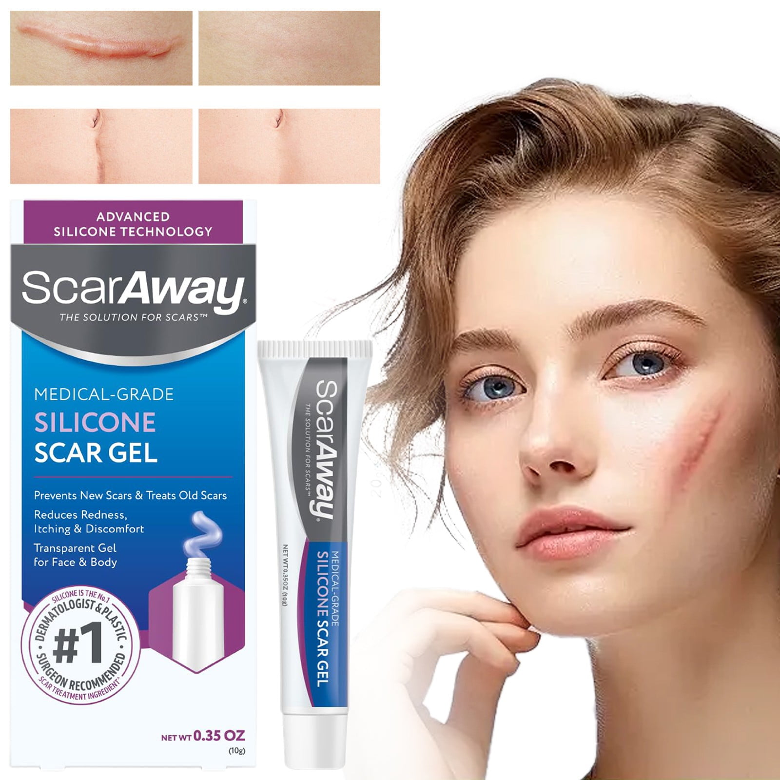 ScarAway Silicone Scar Gel - Medical Grade, Scar Treatment Gel with ...