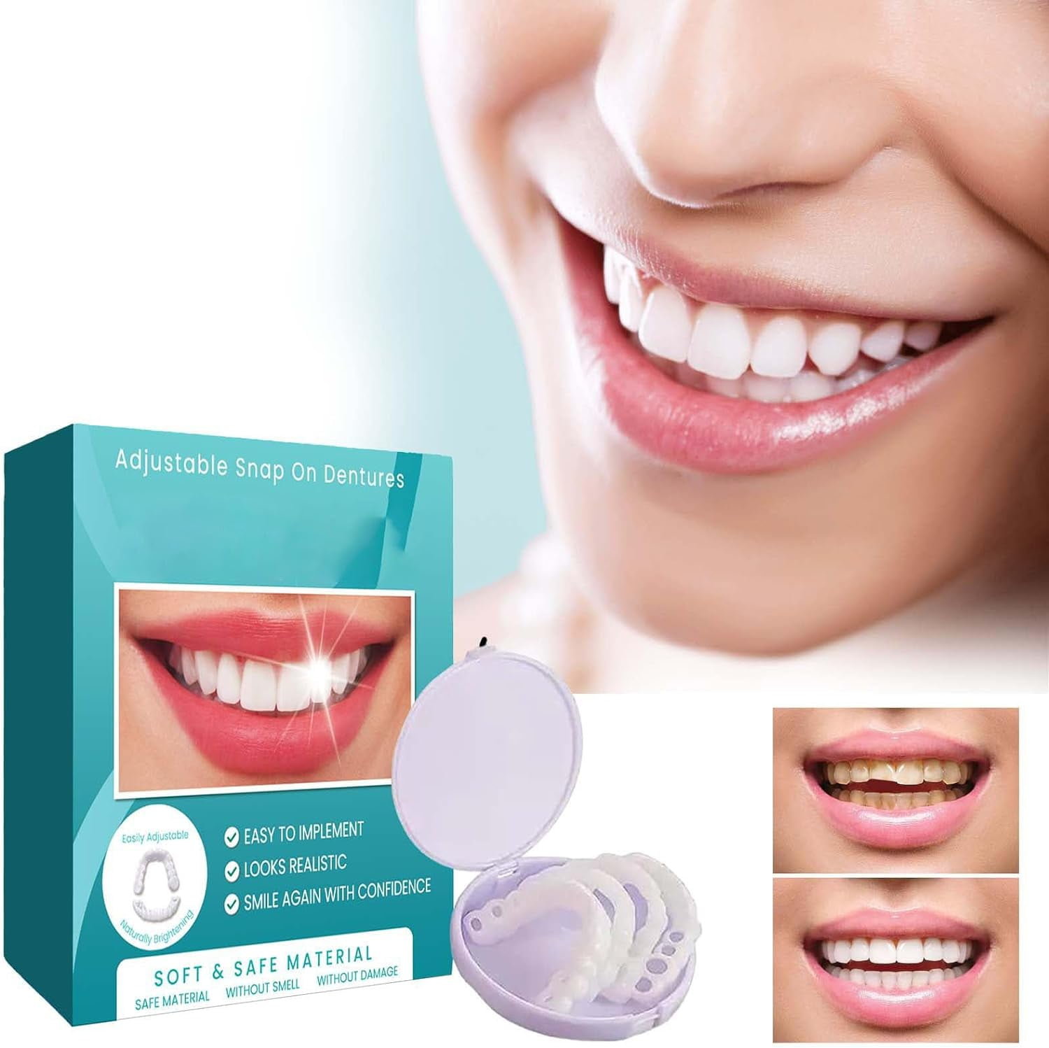 Scheam 1 pcs Temporary Teeth Perfect Cover,Adjustable Snap On,Teeth ...