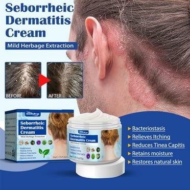 Exederm Flare Control Cream for Eczema & Dermatitis, 2.0 OZ - Walmart.com