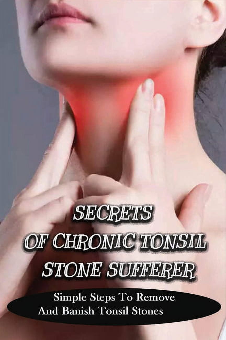 Secrets Of Chronic Tonsil Stone Sufferer: Simple Steps To Remove And Banish Tonsil Stones: How ...