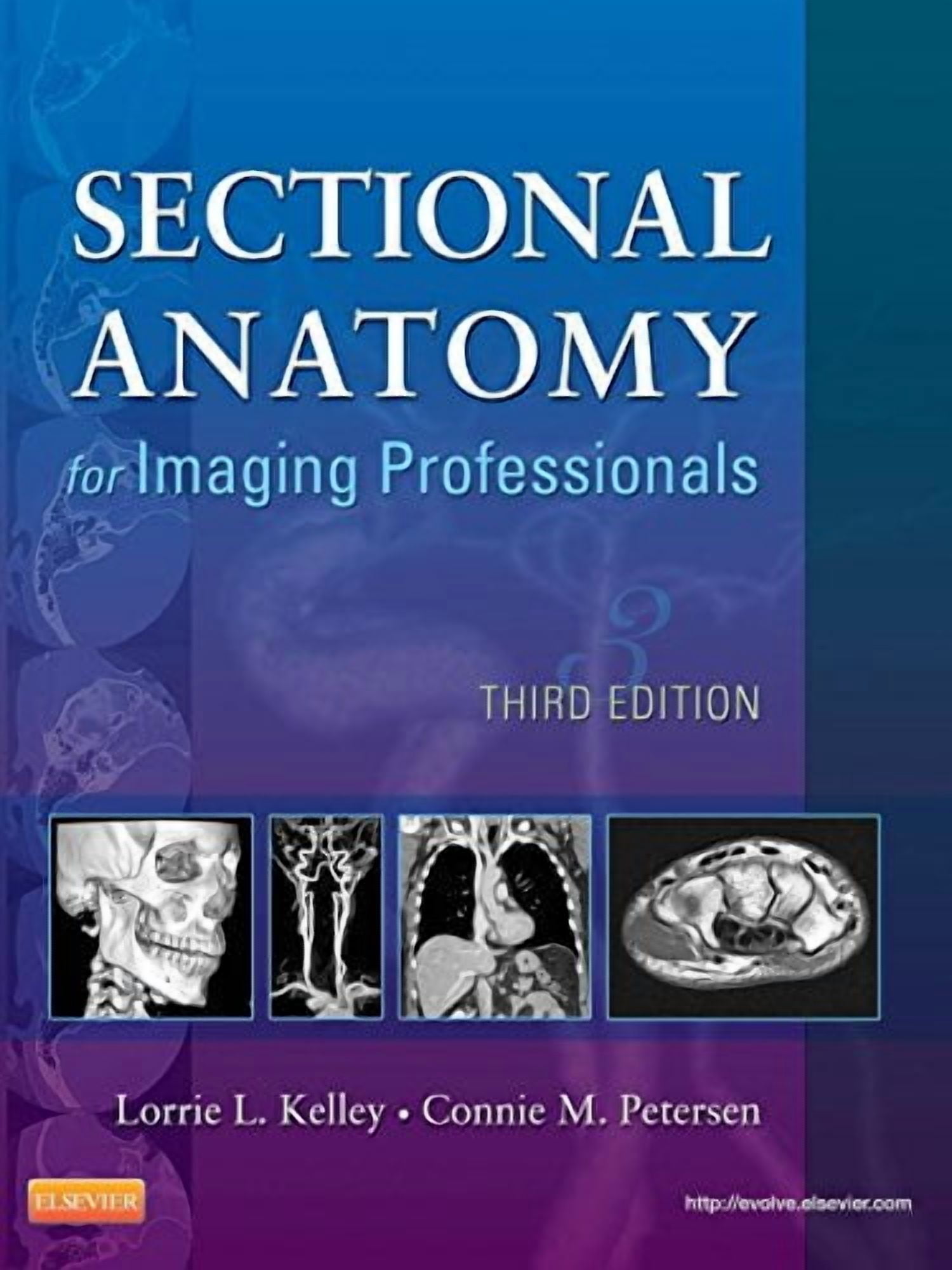 Sectional Anatomy for Imaging Professionals (Paperback) - Walmart.com