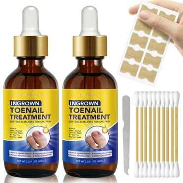 Dr. Scholl's Ingrown Toenail Pain Reliever kit- OTC Foot Care Treatment ...