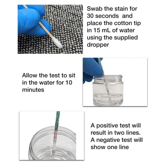 Amniotic Fluid Test Strips